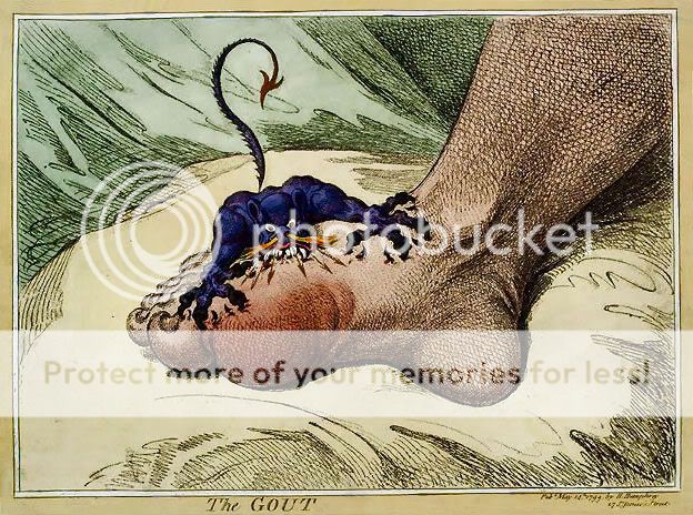 Health: Any MTB'ers on here suffer from Gout? | Rotorburn